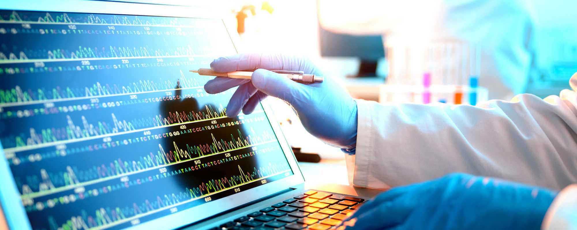 Capillary Electrophoresis: Instrument Price and Cost Considerations