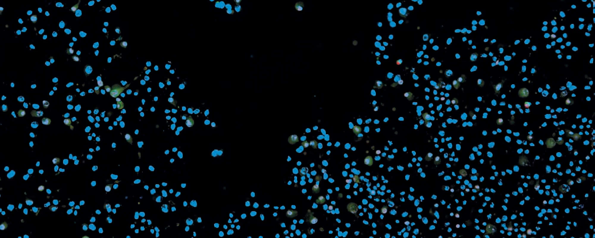 Tecan Announces New Enabling Solutions Targeting Key Areas In Lab Automation Liquid Biopsy And