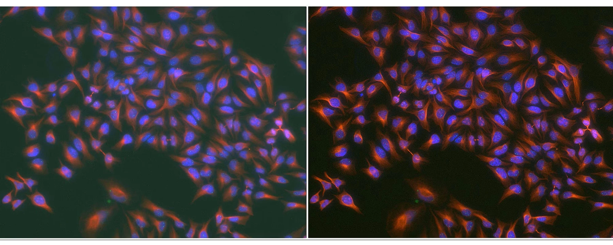 Advancing Live-Cell and Time-Lapse Imaging with Digital Microscopy