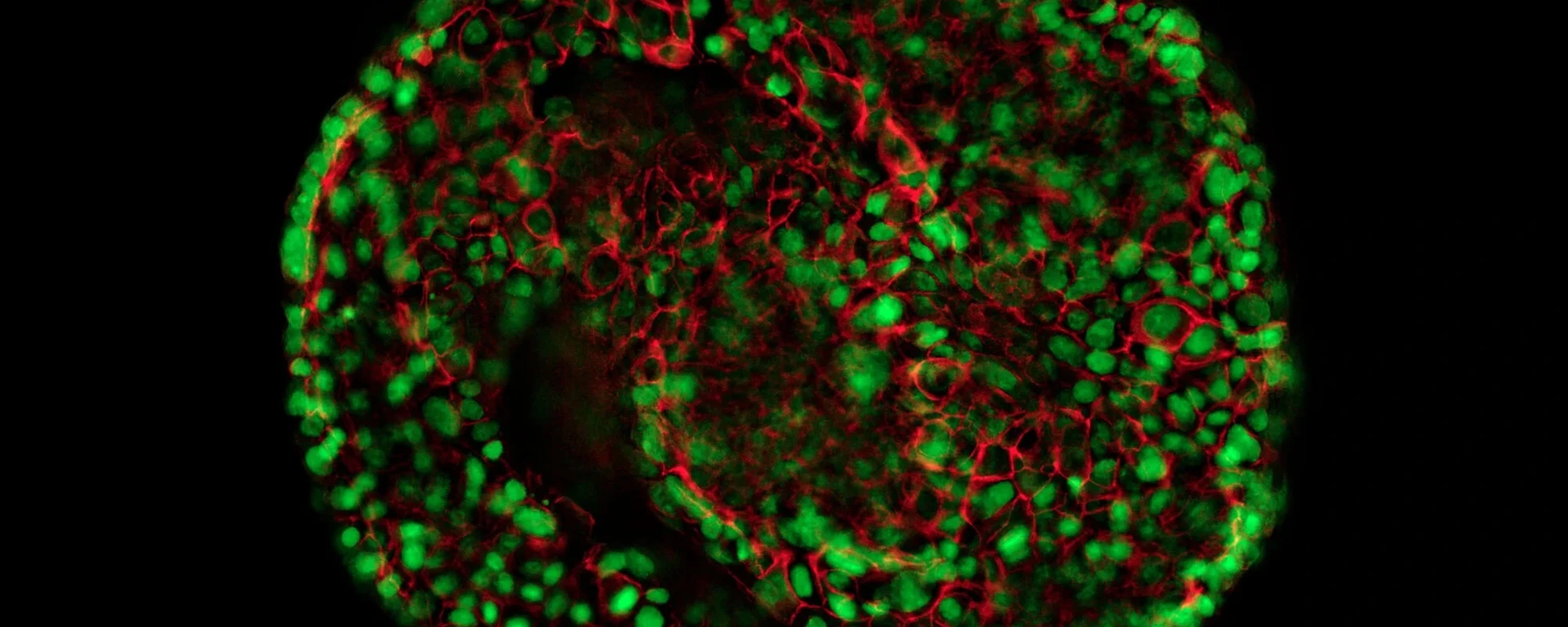 3D Cell Imaging and Analysis: How the Landscape Is Changing