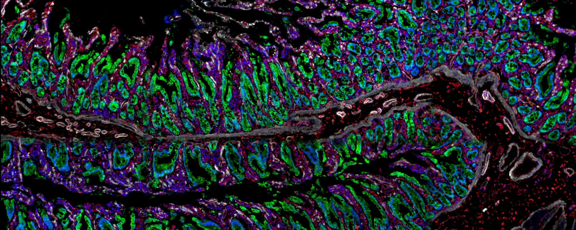 Remapping Research and Discovery with Spatial Imaging