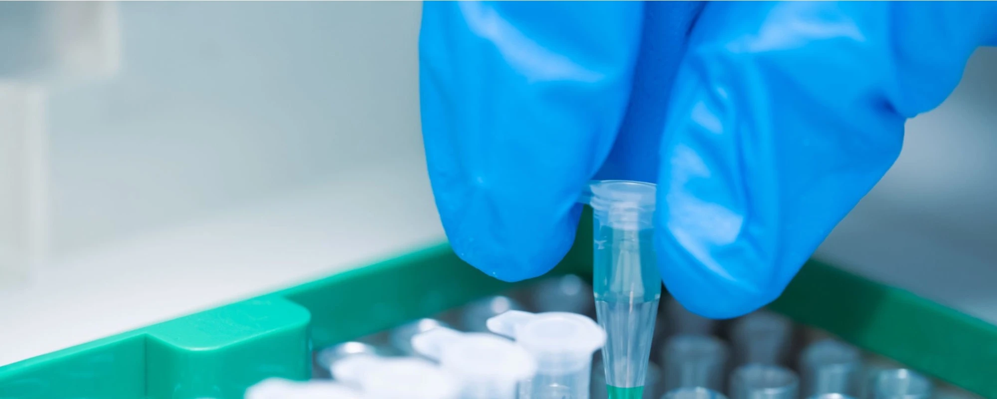 Single Use Plastics: How to Manage these Major Contributors to Lab Waste