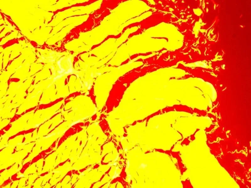 Nikon Eclipse TE2000-E Inverted Fluorescence Motorized Microscope Pred ...