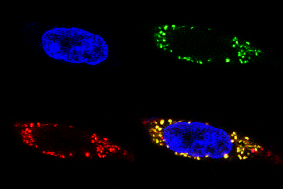 Mitochondrial GFP mRNA for Cell Imaging & Organelle Labeling (m1Ψ ...